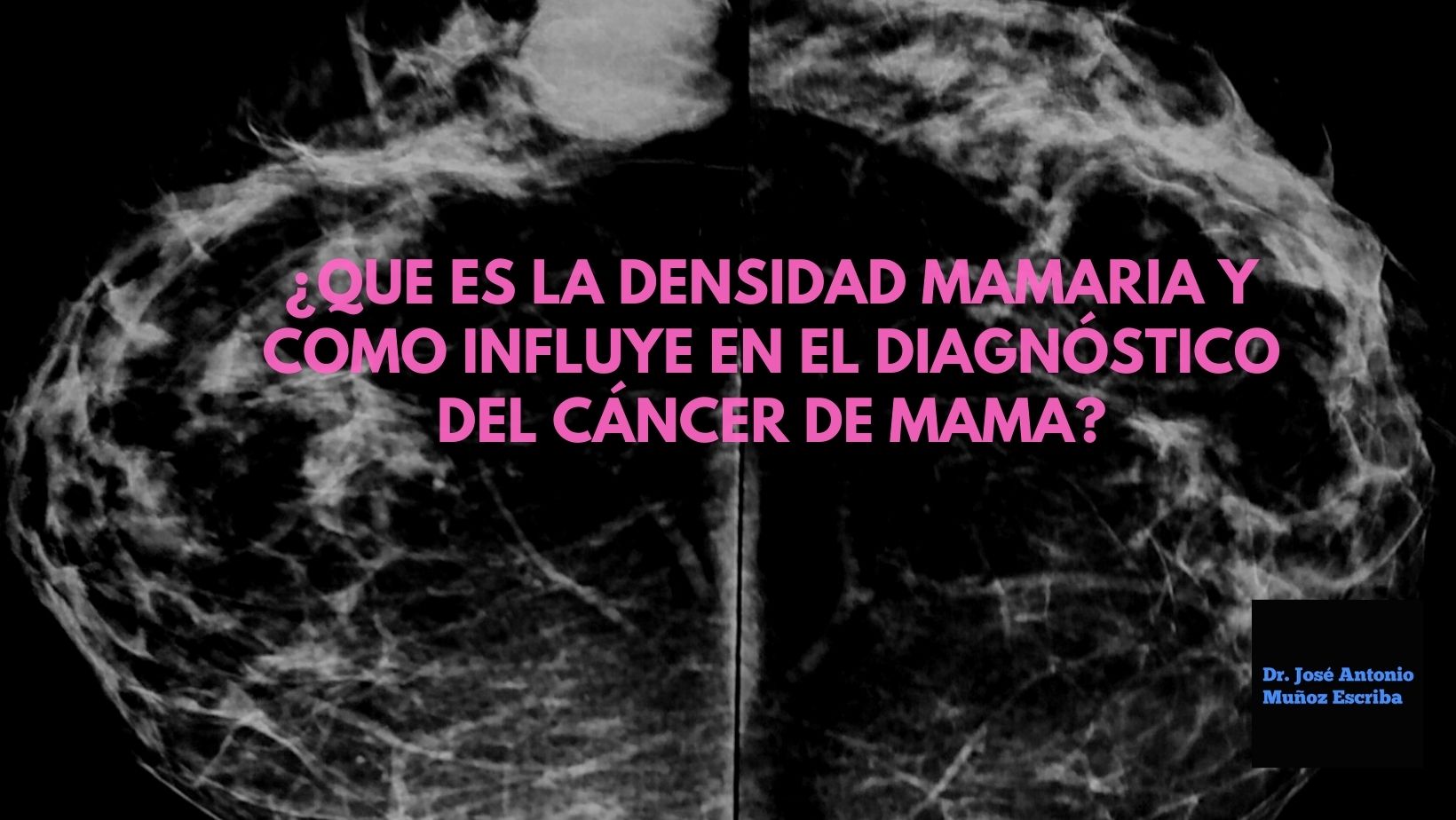¿Que es la densidad mamaria y como influye en el diagnóstico del cáncer ...
