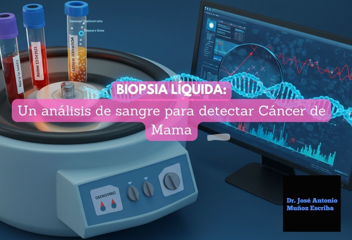 Biopsia Líquida un análisis de sangre para detectar Cáncer de Mama – Dr ...